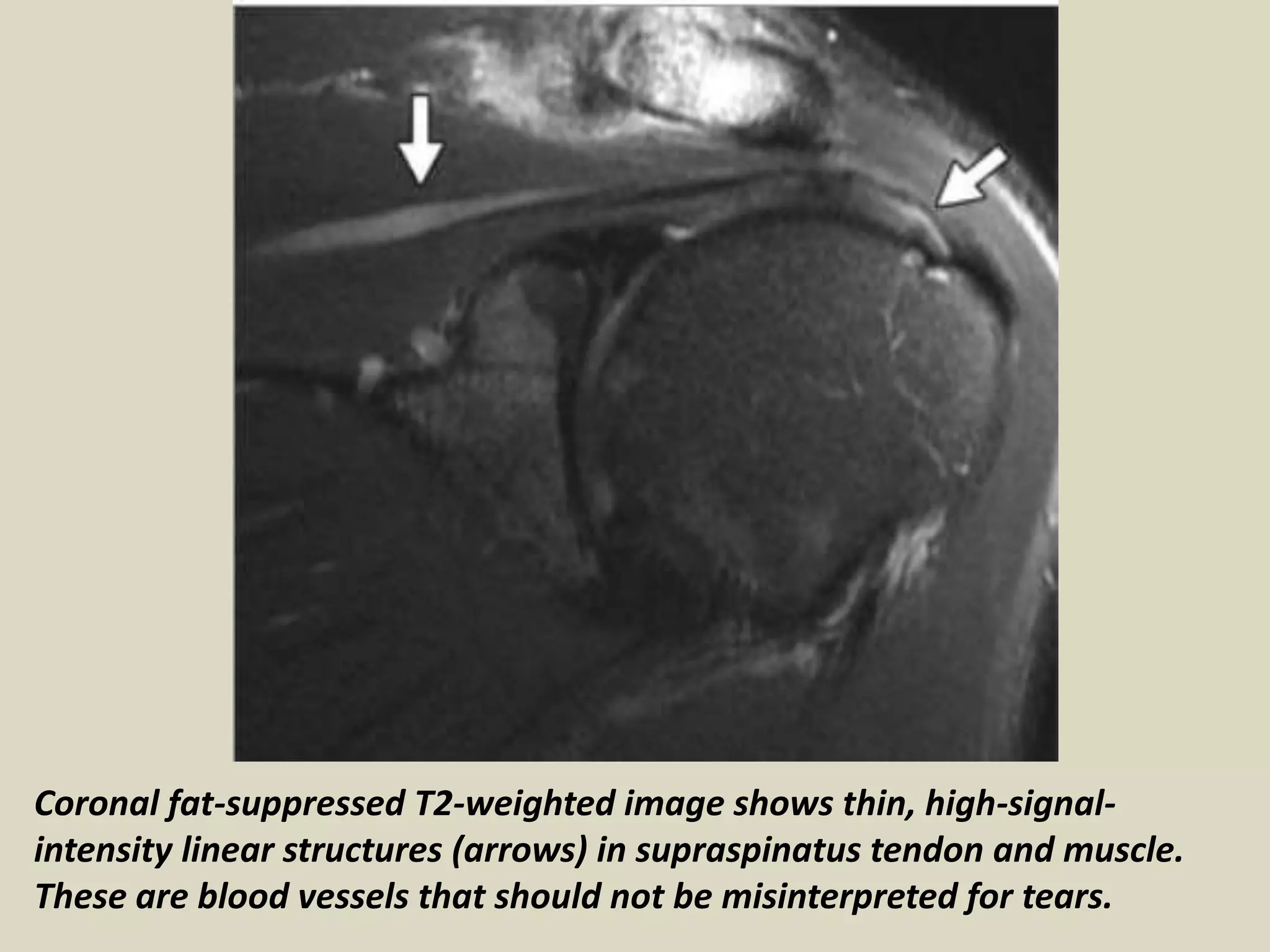 Presentation1, radiological imaging of artifact and pitfalls in ...