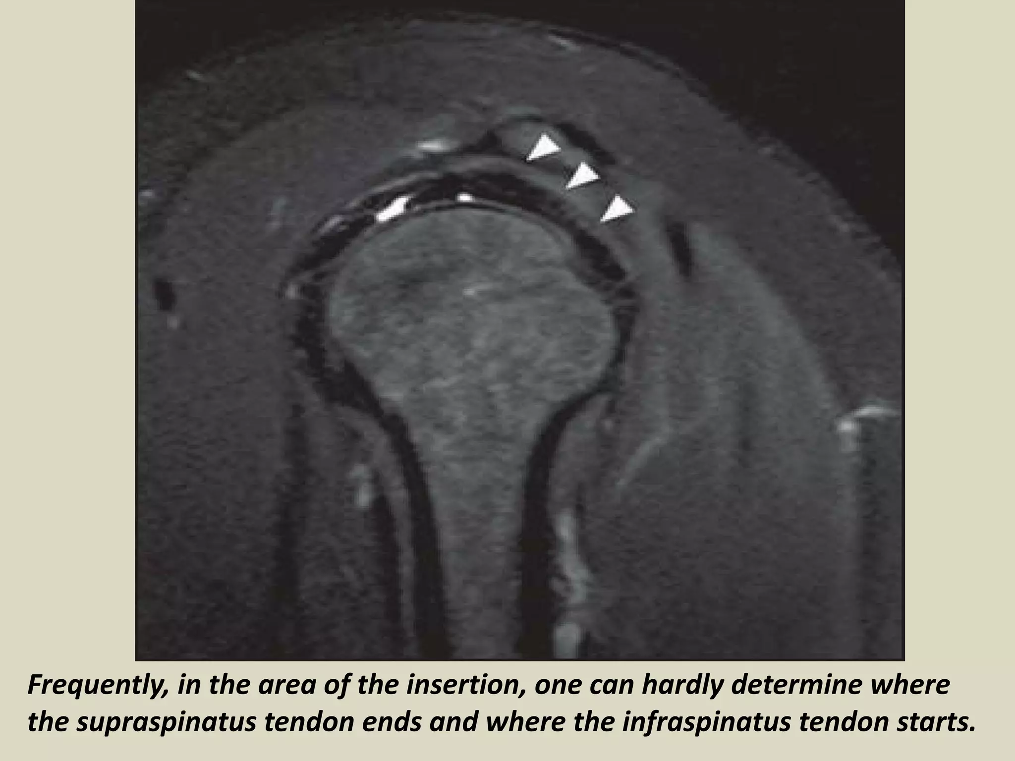 Presentation1, radiological imaging of artifact and pitfalls in ...