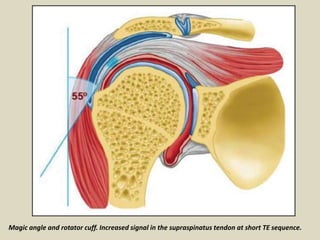 Presentation1, radiological imaging of artifact and pitfalls in ...