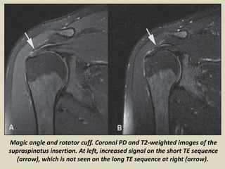 Presentation1, radiological imaging of artifact and pitfalls in ...