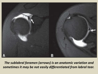 Presentation1, radiological imaging of artifact and pitfalls in ...