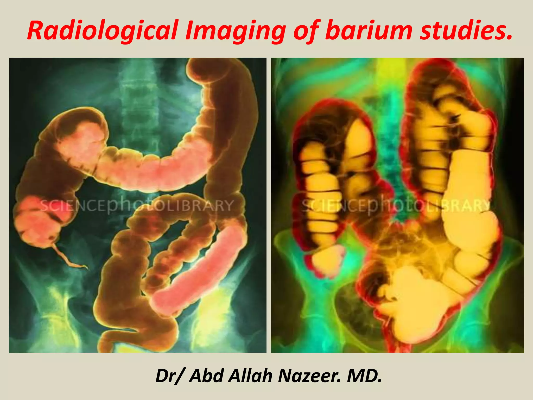 Presentation1, radiological imaging of barium studies. | PPTX