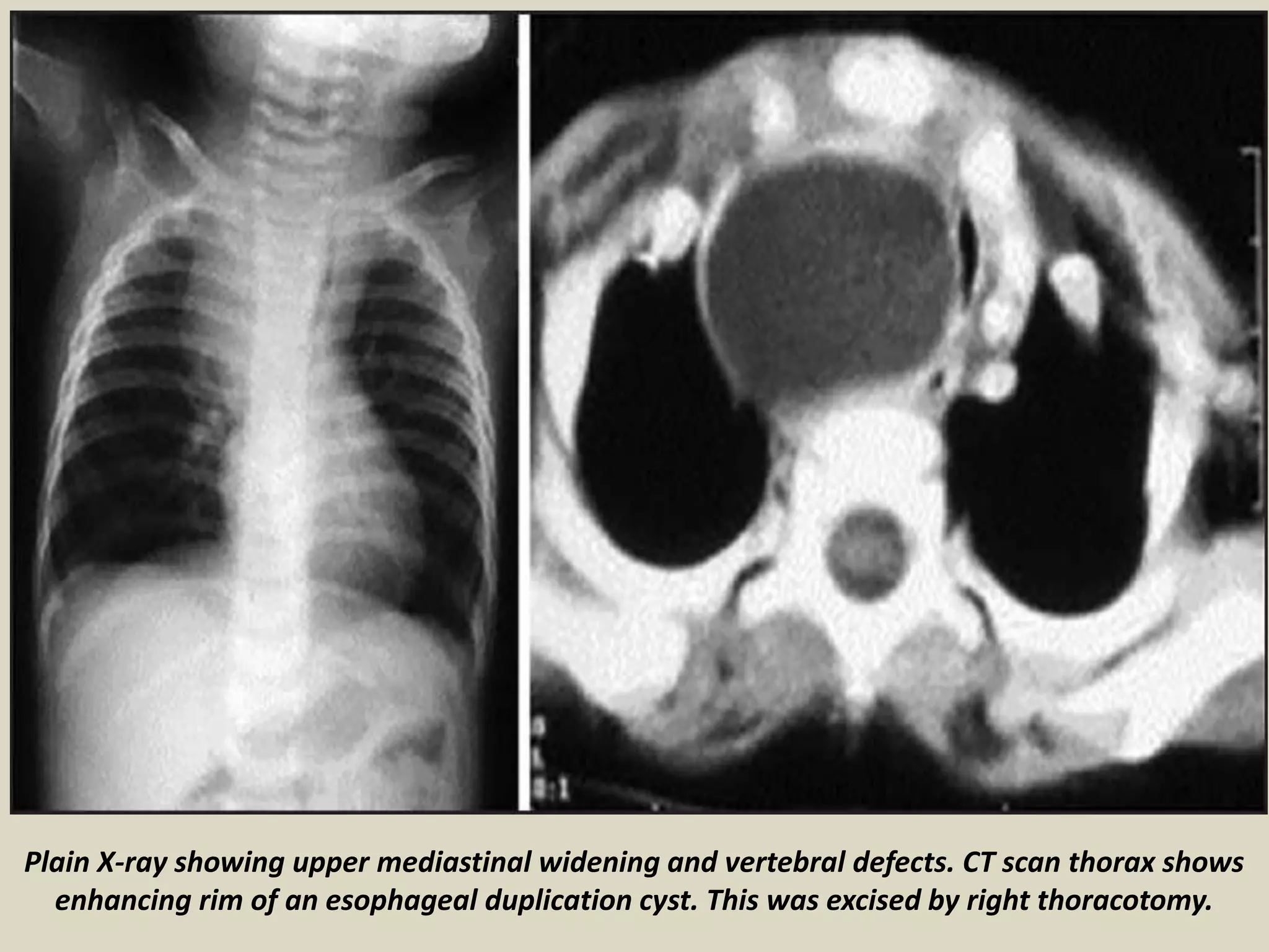 Presentation1, radiological imaging of barium studies. | PPTX