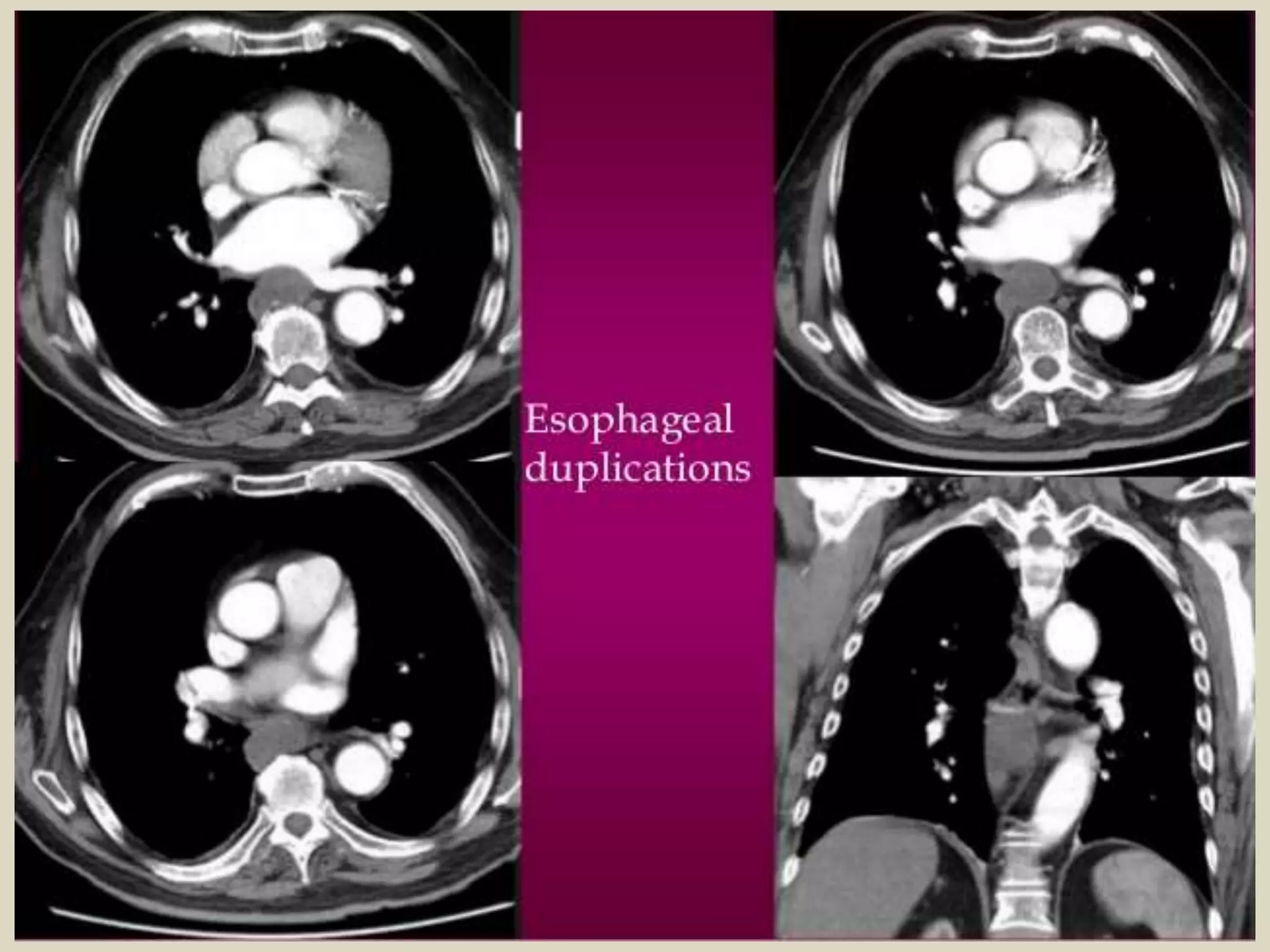 Presentation1, radiological imaging of barium studies. | PPTX