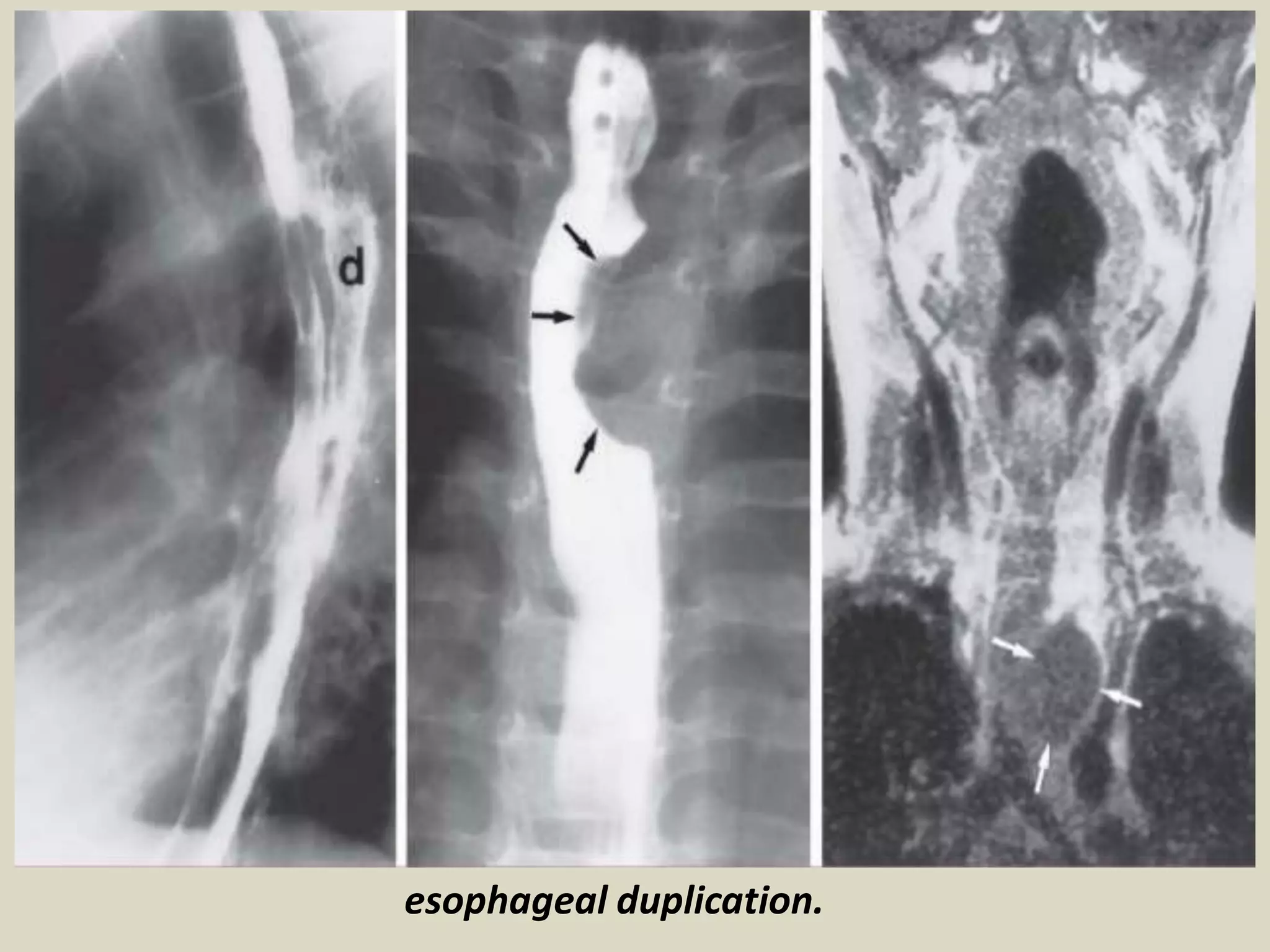 Presentation1, radiological imaging of barium studies. | PPTX