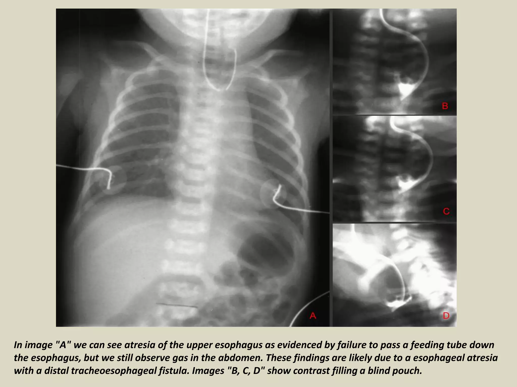 Presentation1, radiological imaging of barium studies. | PPTX