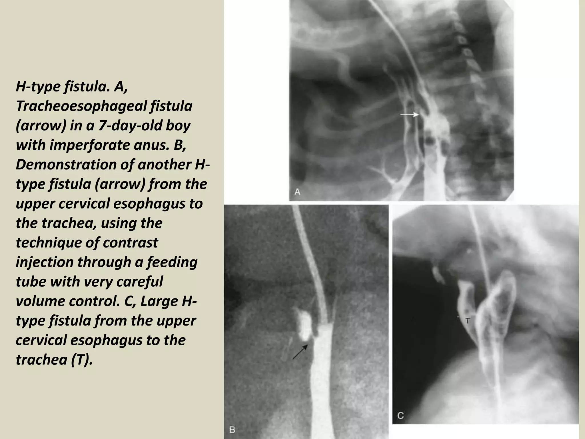 Presentation1, radiological imaging of barium studies. | PPTX