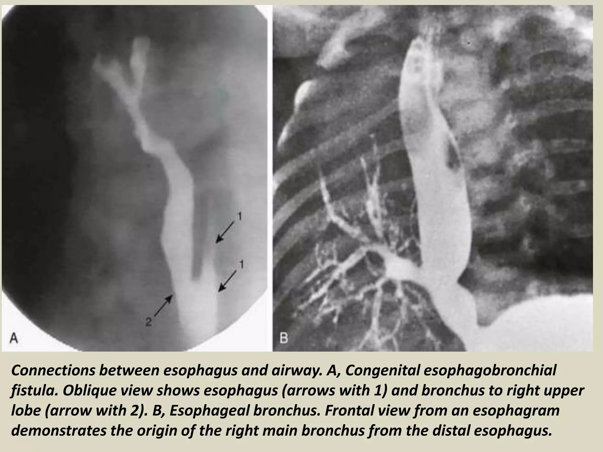 Presentation1, radiological imaging of barium studies. | PPTX