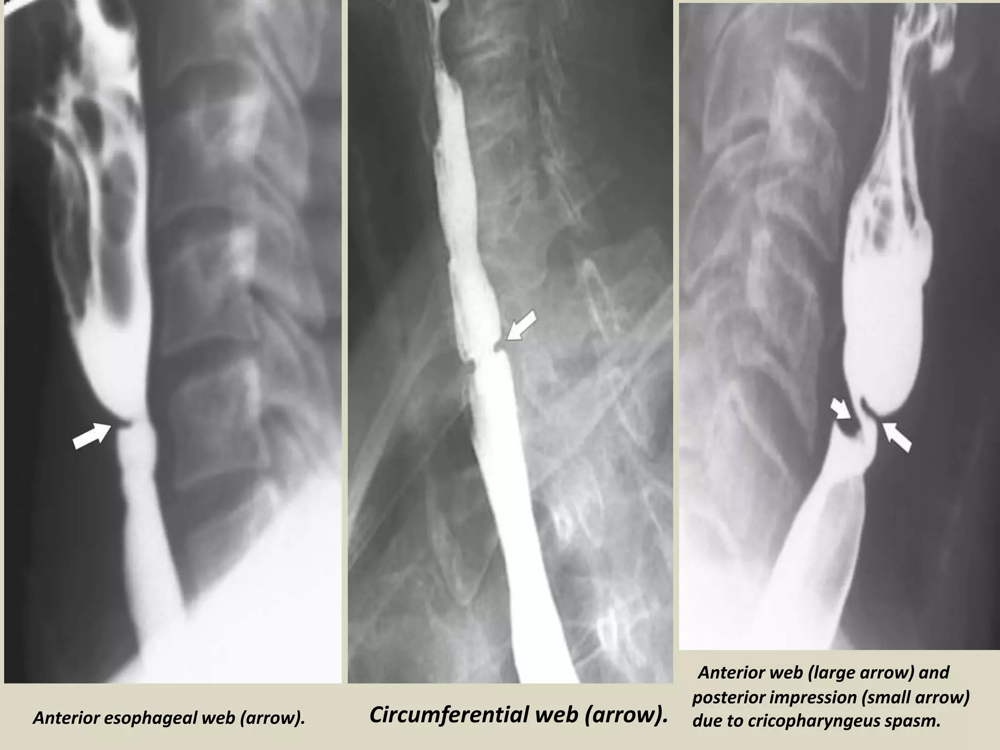 Presentation1, radiological imaging of barium studies. | PPTX