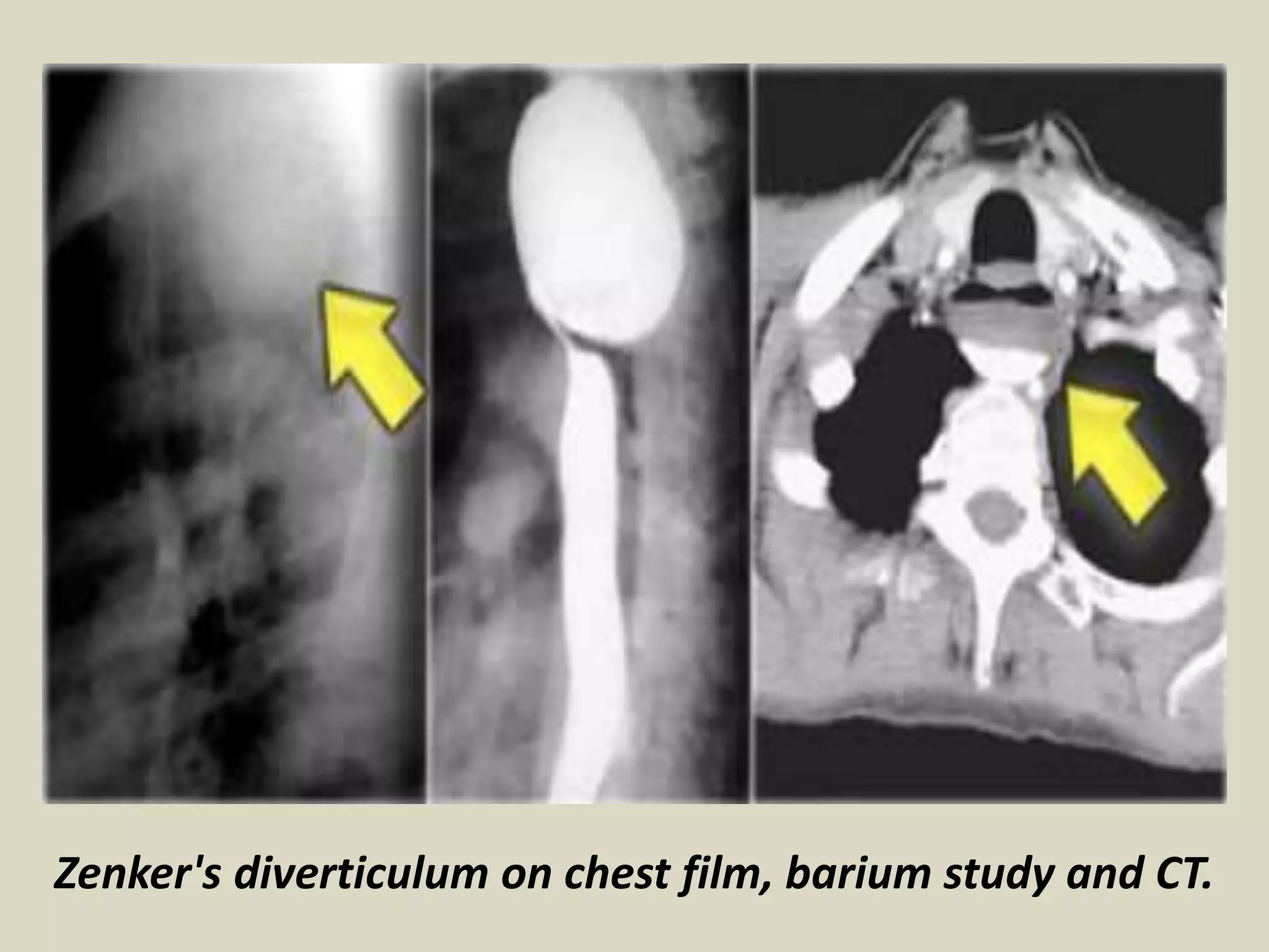 Presentation1, radiological imaging of barium studies. | PPTX