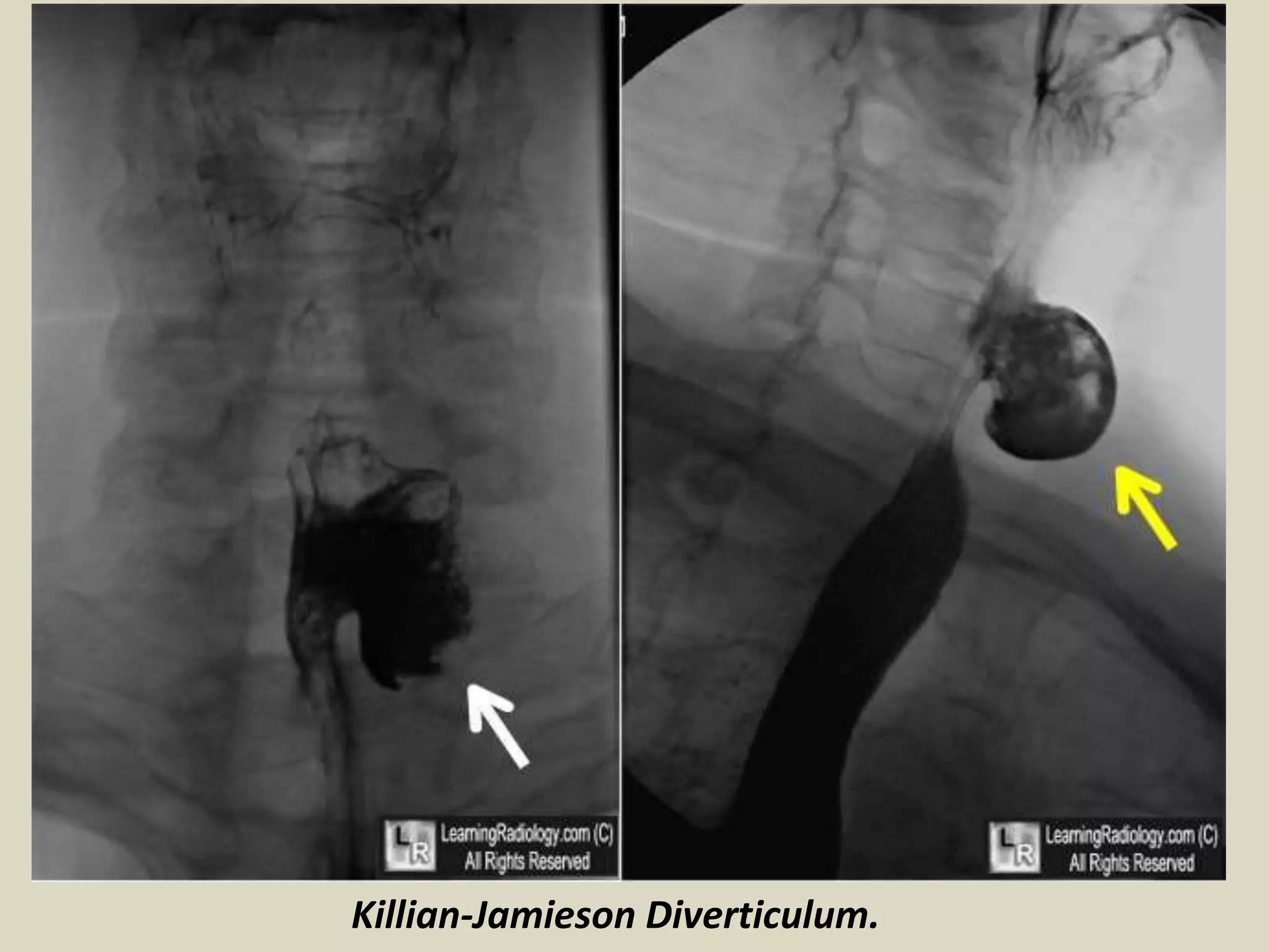 Presentation1, radiological imaging of barium studies. | PPTX