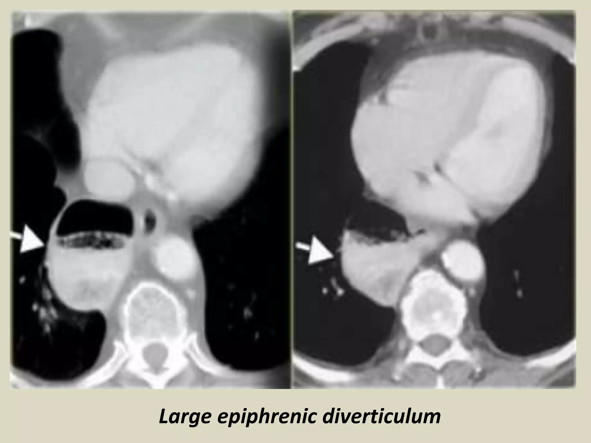 Presentation1, radiological imaging of barium studies. | PPTX