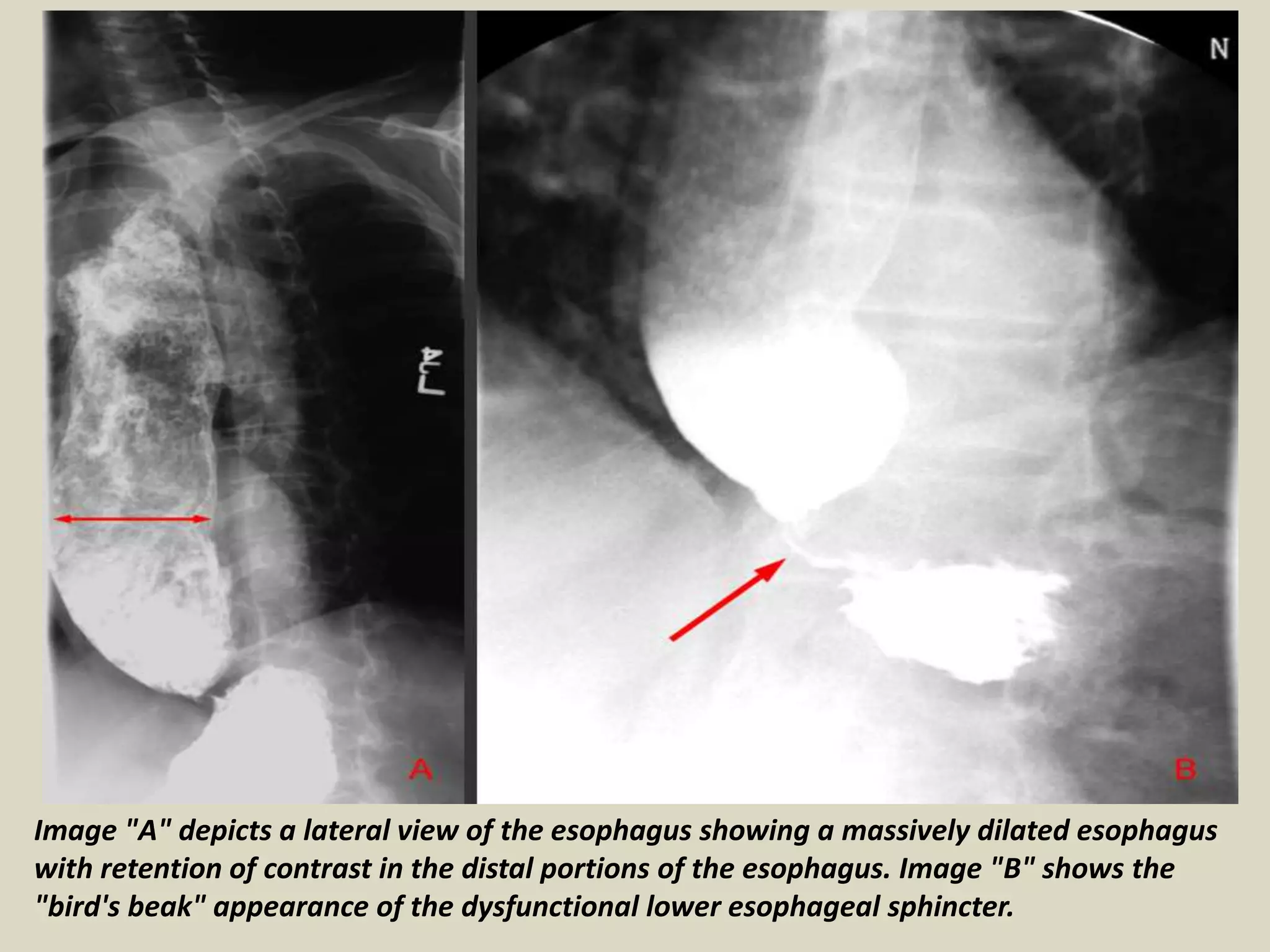Presentation1, radiological imaging of barium studies. | PPTX