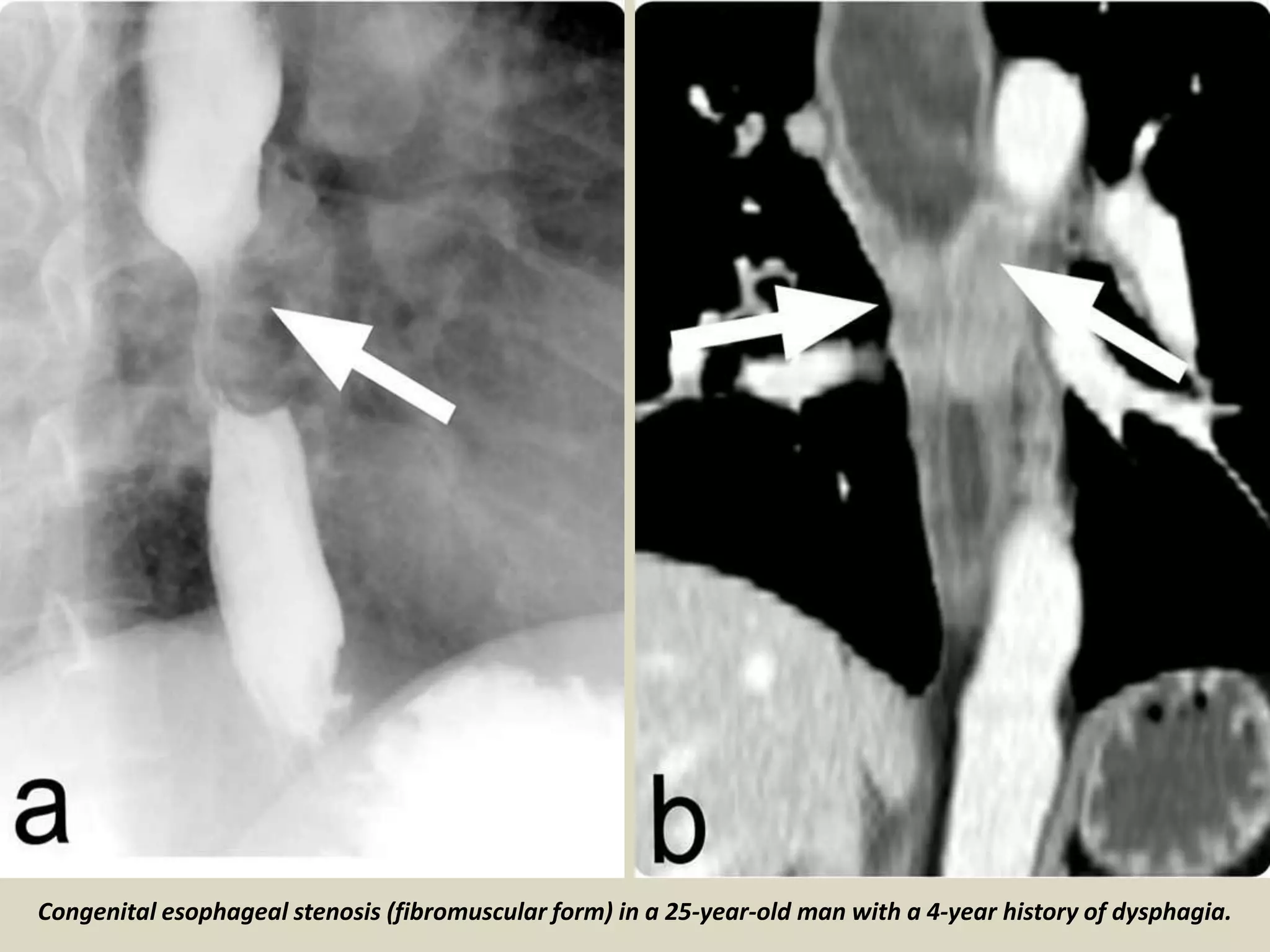 Presentation1, radiological imaging of barium studies. | PPTX