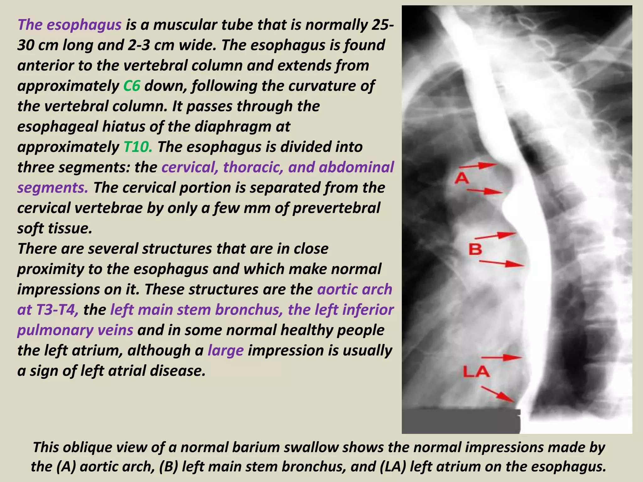 Presentation1, radiological imaging of barium studies. | PPTX