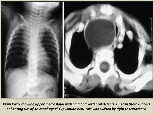 Presentation1, radiological imaging of barium studies. | PPTX ...