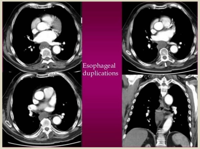 Presentation1, radiological imaging of barium studies. | PPTX ...