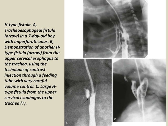Presentation1, radiological imaging of barium studies. | PPTX ...