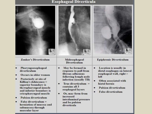 Presentation1, radiological imaging of barium studies. | PPTX ...