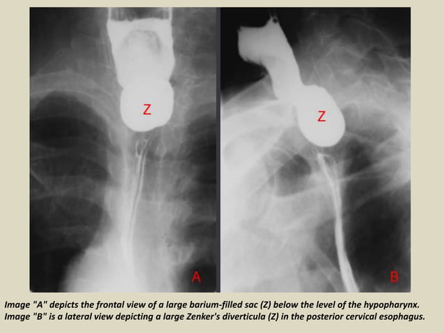Presentation1, radiological imaging of barium studies. | PPTX ...