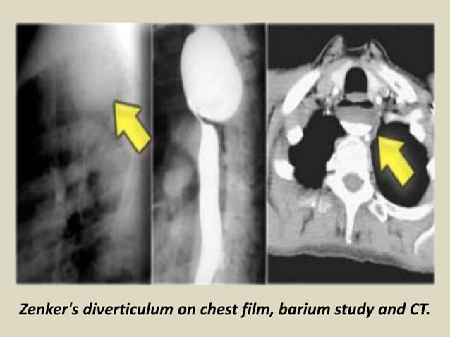 Presentation1, radiological imaging of barium studies. | PPTX ...