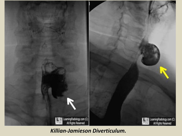 Presentation1, radiological imaging of barium studies. | PPTX ...