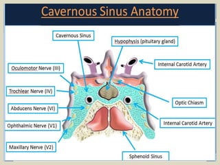 Septic Cavernous Sinus Thrombosis: A Review ScienceDirect, 50% OFF