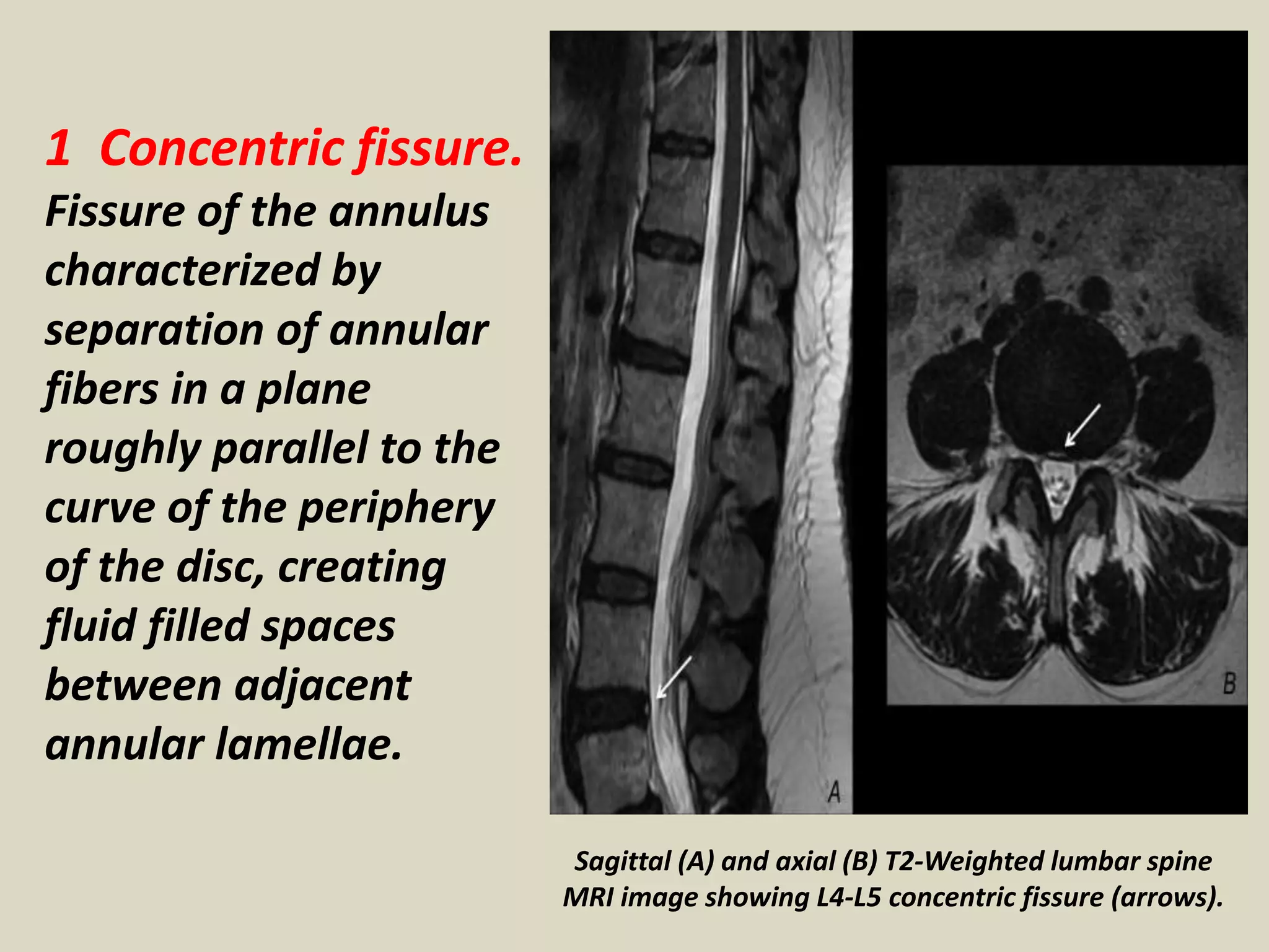 Presentation1, radiological imaging of degenerative and inflammatory ...