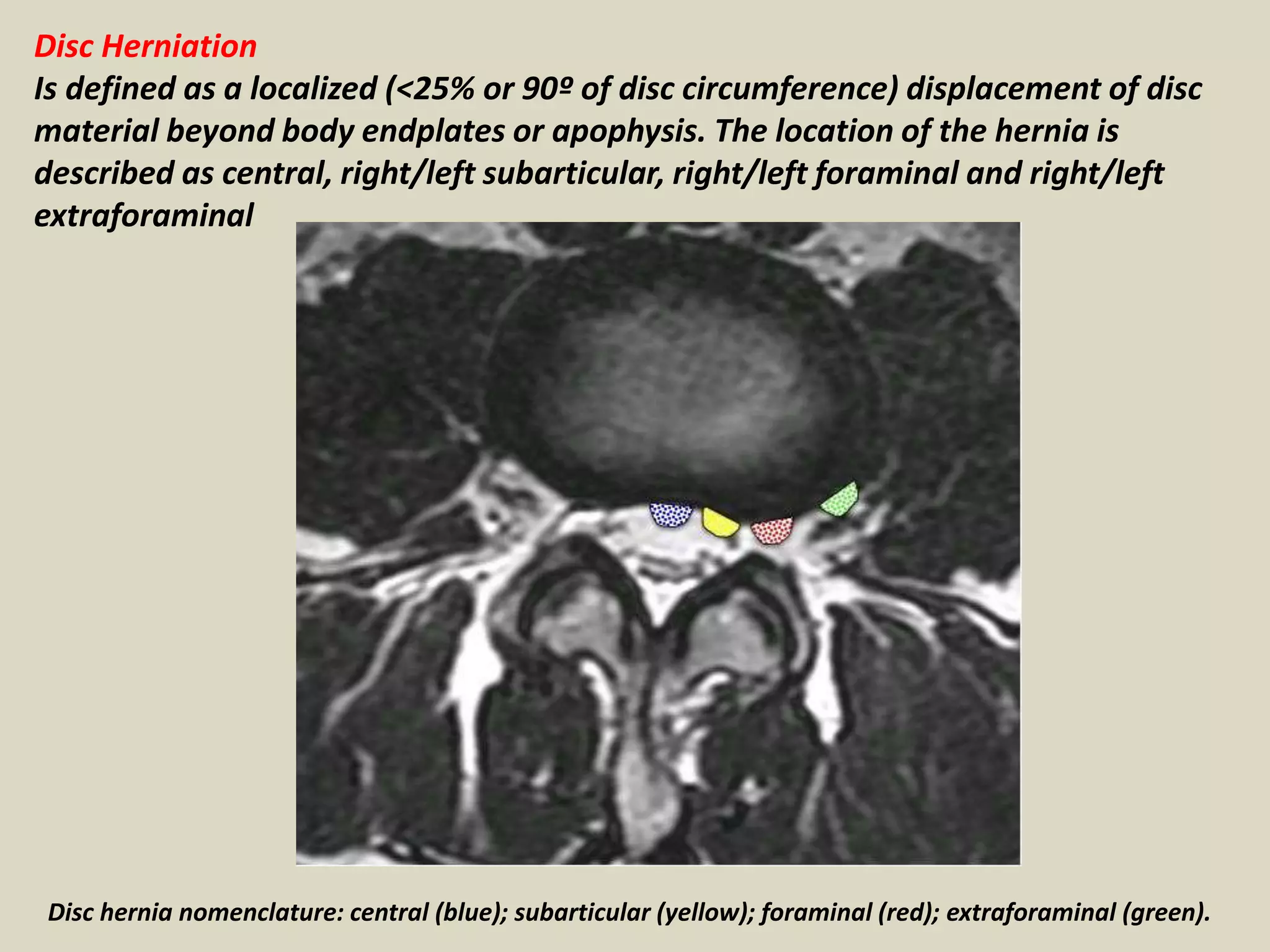 Presentation1, radiological imaging of degenerative and inflammatory ...
