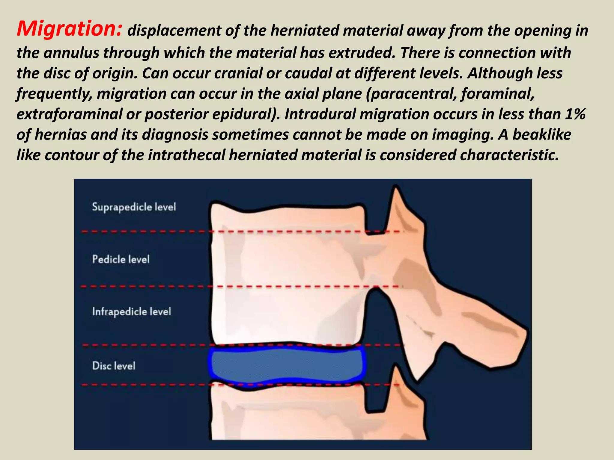 Presentation1, radiological imaging of degenerative and inflammatory ...