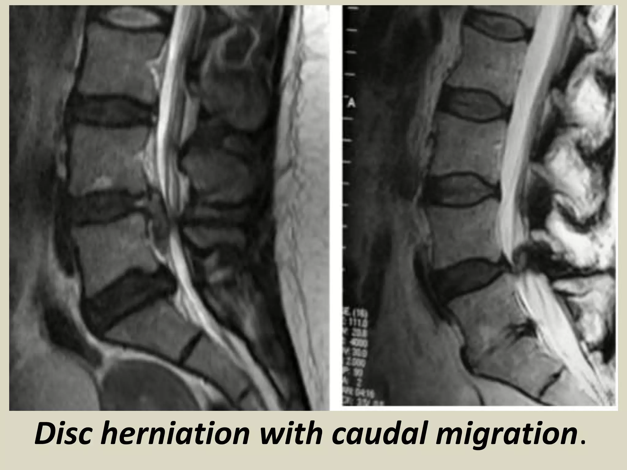 Presentation1, radiological imaging of degenerative and inflammatory ...