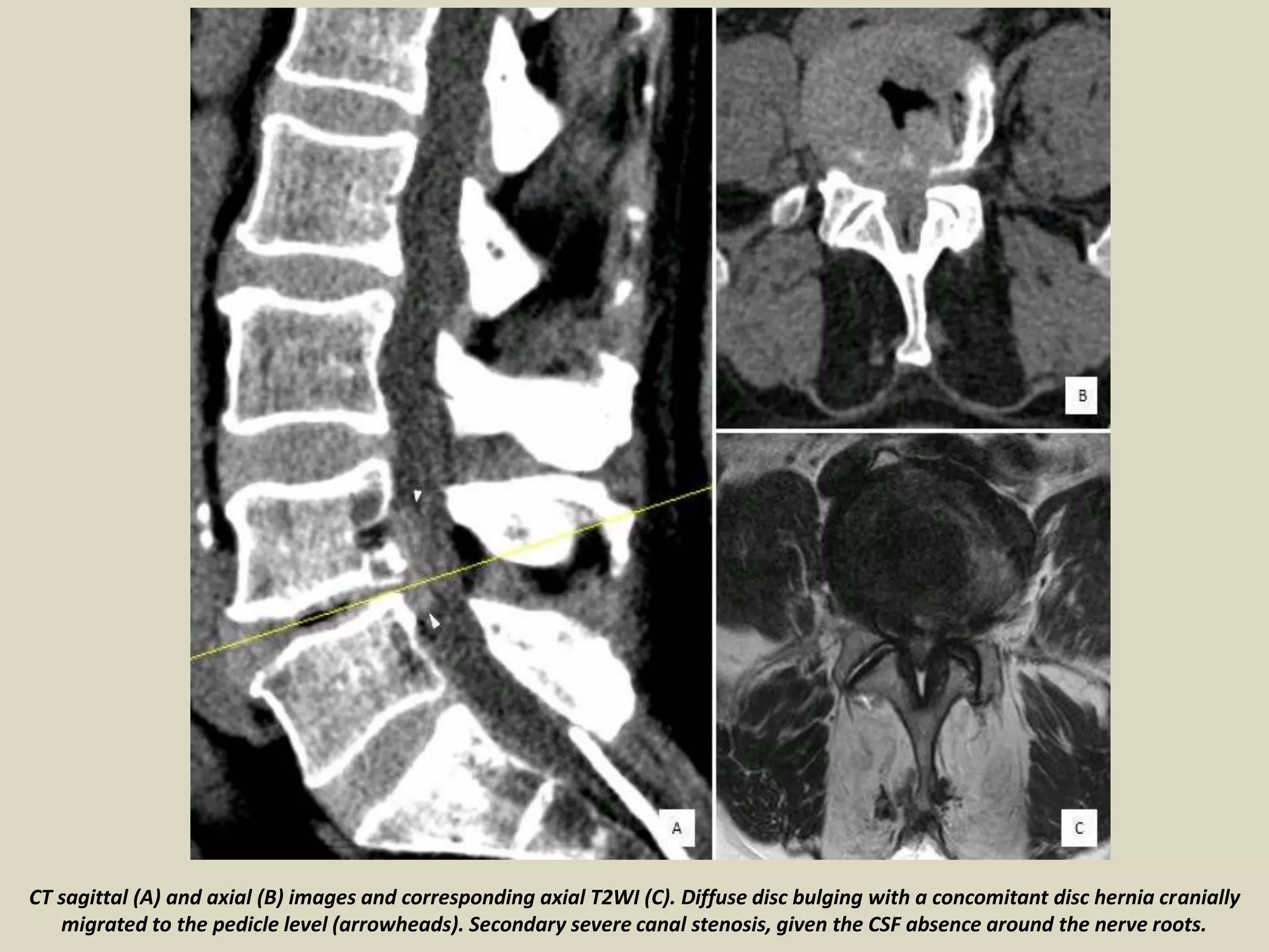 Presentation1, radiological imaging of degenerative and inflammatory ...