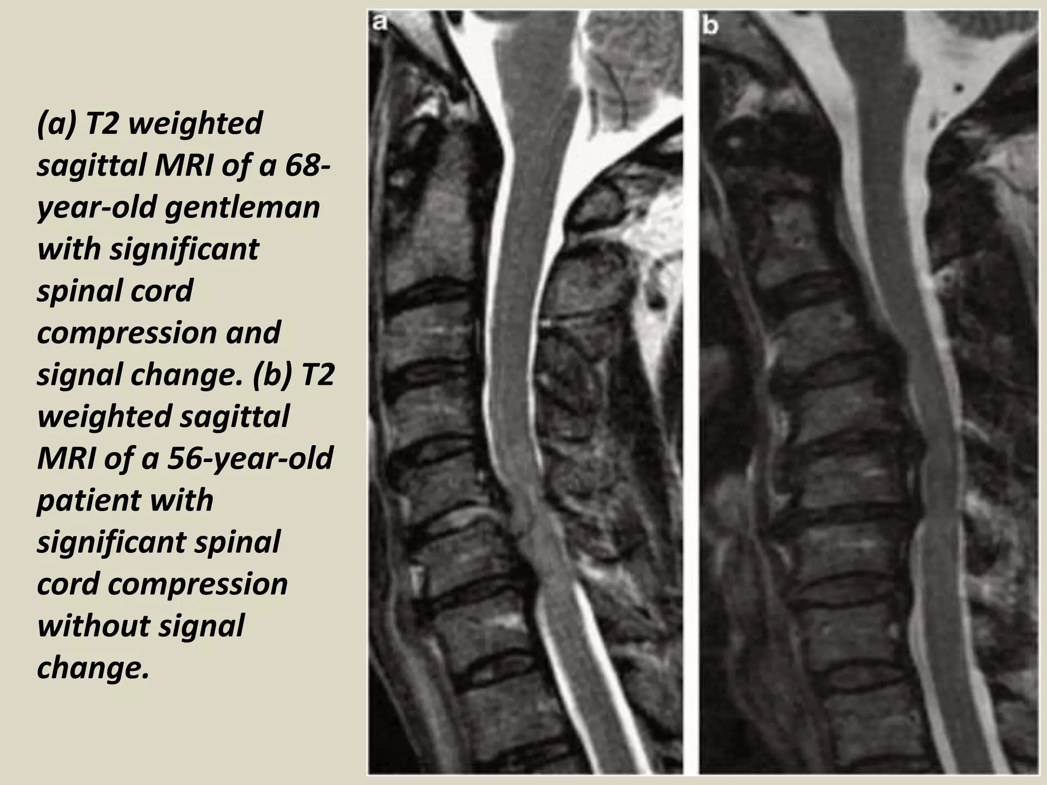 Presentation1, radiological imaging of degenerative and inflammatory ...