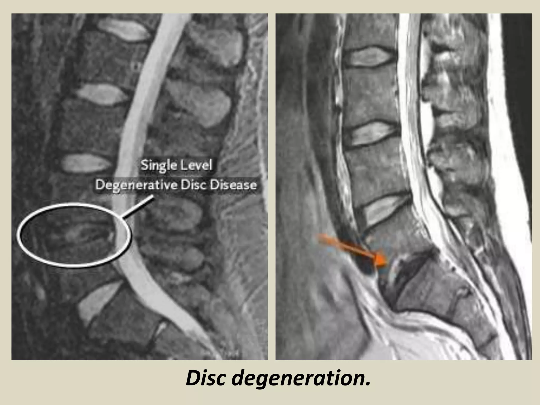 Presentation1, radiological imaging of degenerative and inflammatory ...