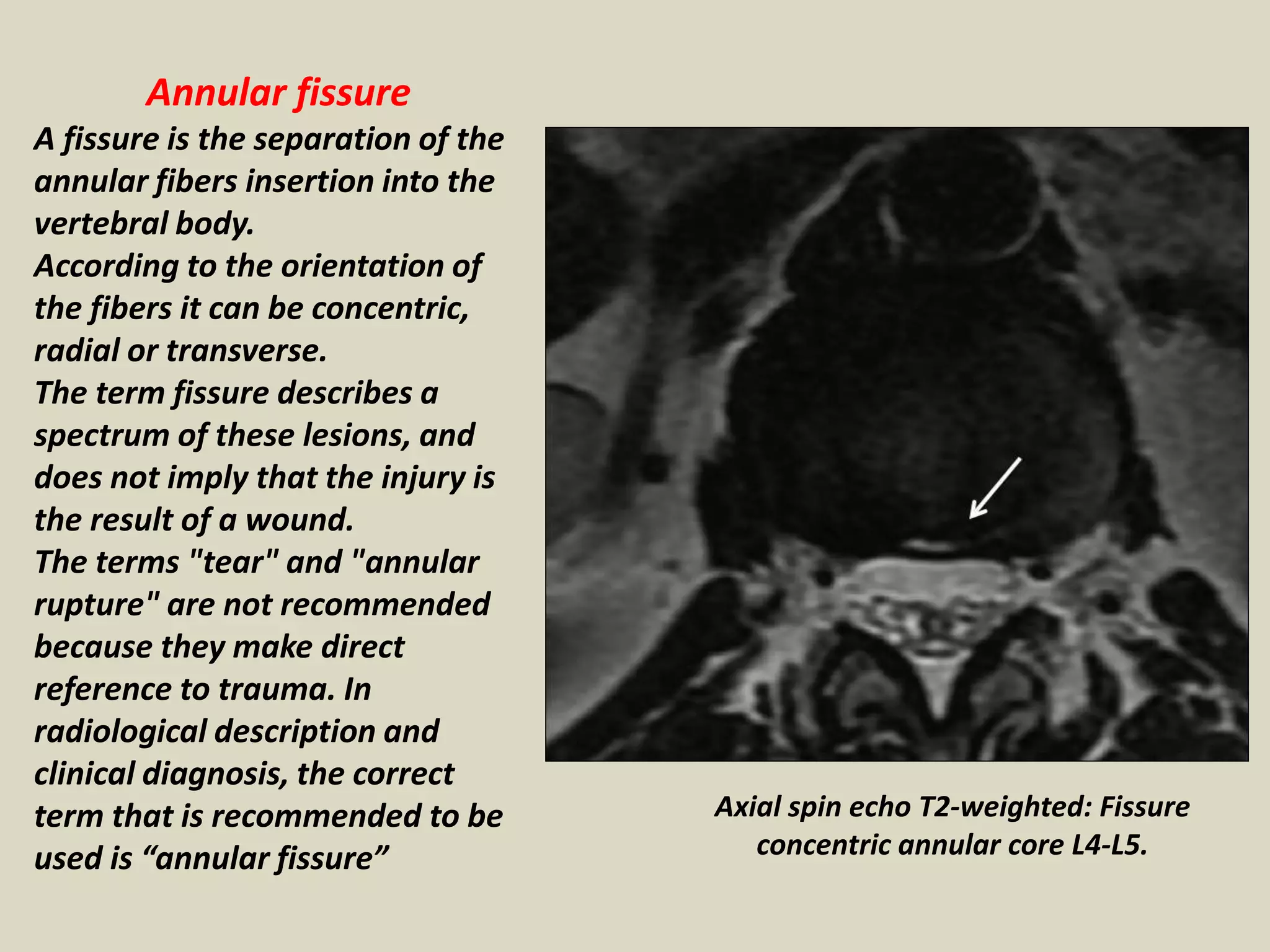 Presentation1, radiological imaging of degenerative and inflammatory ...