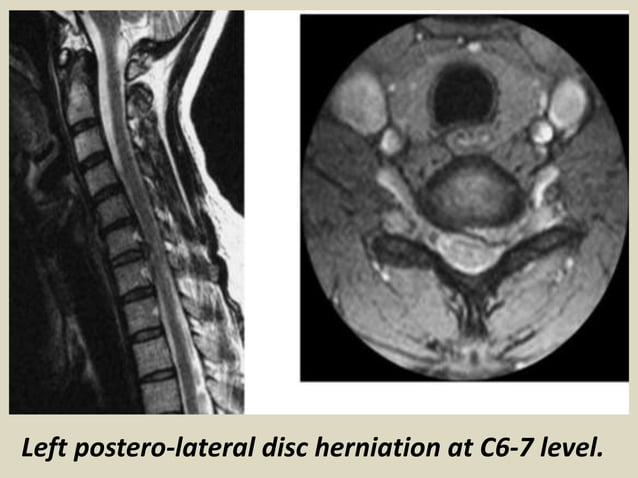 Presentation1, radiological imaging of degenerative and inflammatory ...