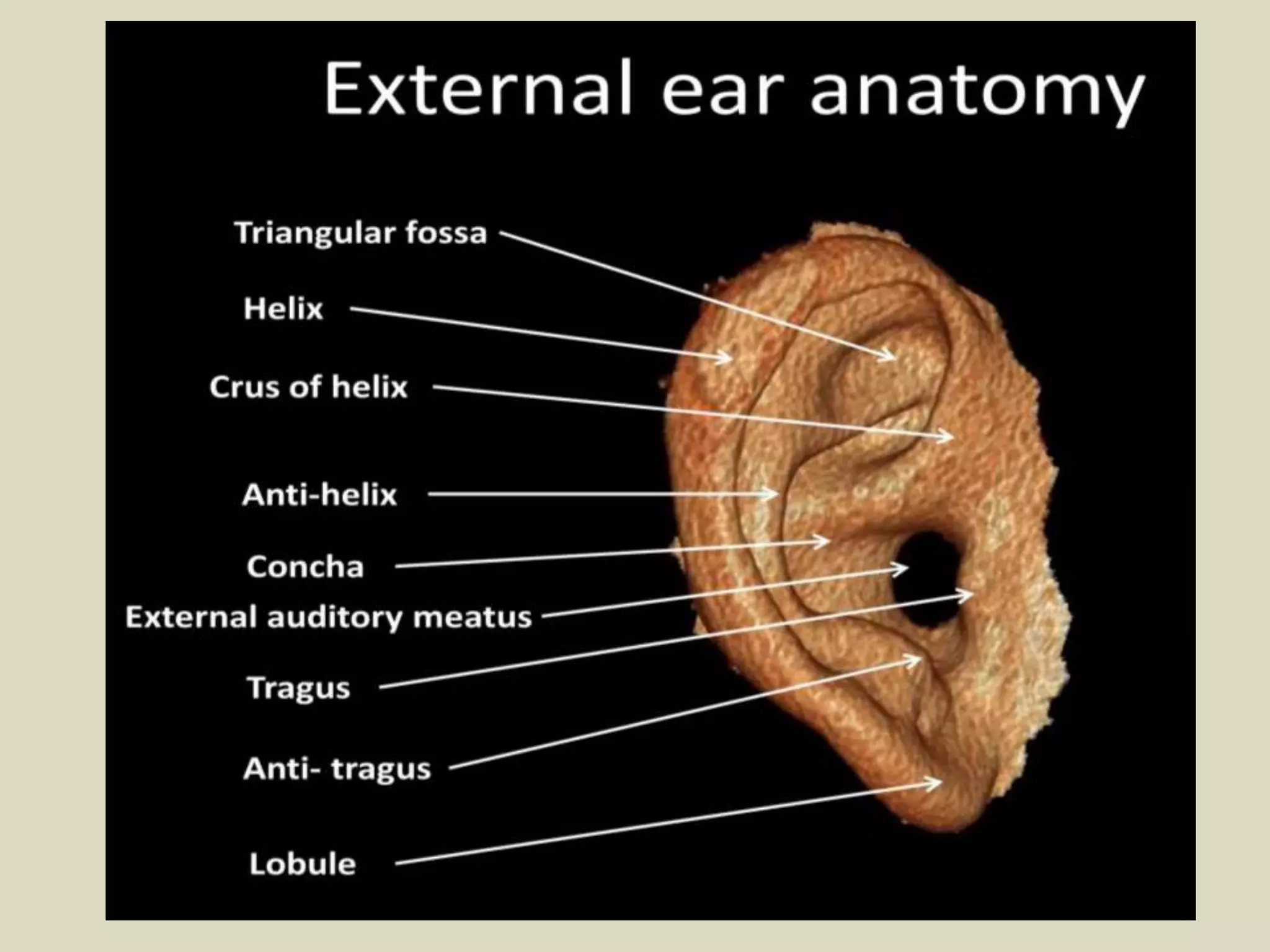 Presentation1, radiological imaging of ear microcia. | PPT