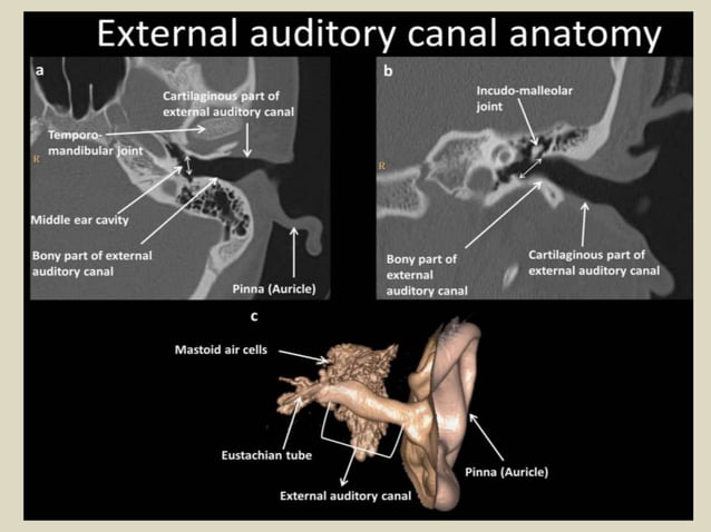 Presentation1, radiological imaging of ear microcia. | PPT