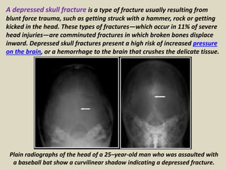 Presentation1, radiological imaging of fractures. | PPTX
