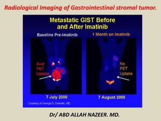 Presentation1, radiological imaging of gastro intestinal stromal tumour ...