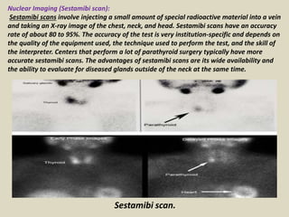Presentation1, radiological imaging of hyperparathyroidism. | PPT
