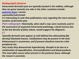 Presentation1, radiological imaging of intra cranial dermoid tumours ...