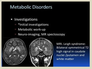 Presentation1, radiological imaging of leigh disease. | PPTX