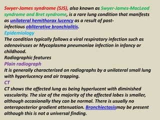 Presentation1, radiological imaging of macleod syndrome. | PPTX