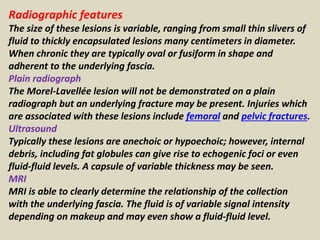 Presentation1, radiological imaging of morel lavallee lesion. | PPTX