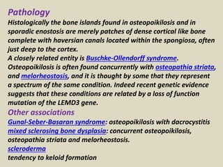 Presentation1, radiological imaging of ostepopikilosis | PPTX