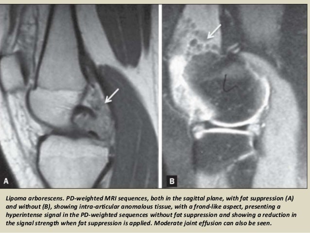 Presentation1, radiological imaging of popliteal fossa masses.