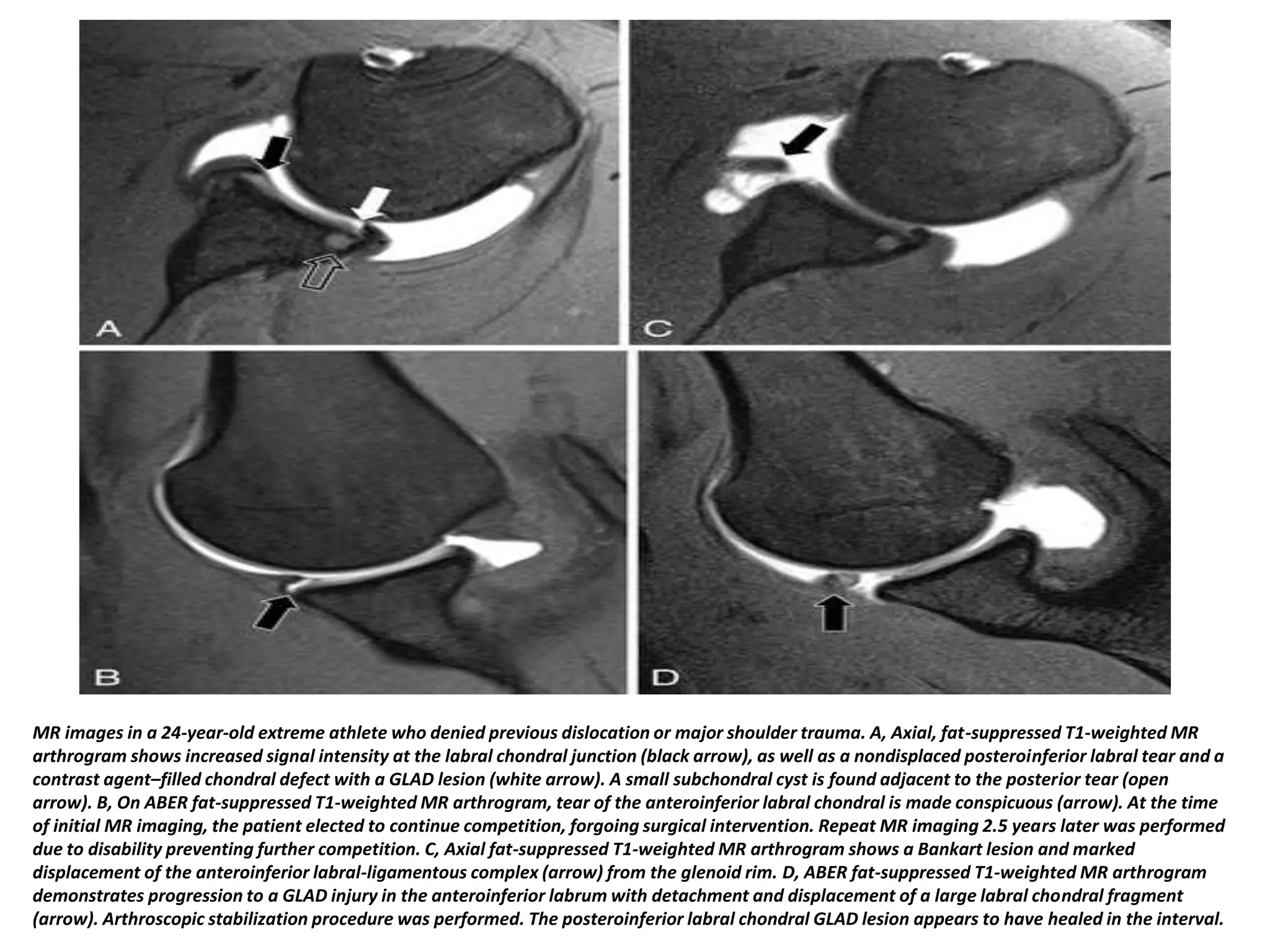 Presentation1, radiological imaging of shoulder dislocation. | PPTX
