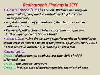 Presentation1, radiological imaging of slipped femoral capital ...