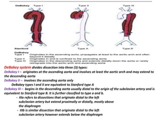 Presentation1, radiological imaging of thoracic aortic aneurysm. | PPT